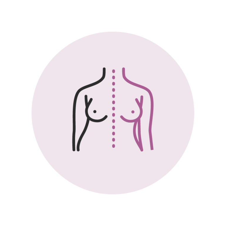 Liposuction Appleton | Green Bay | Dr. Tina Sauerhammer